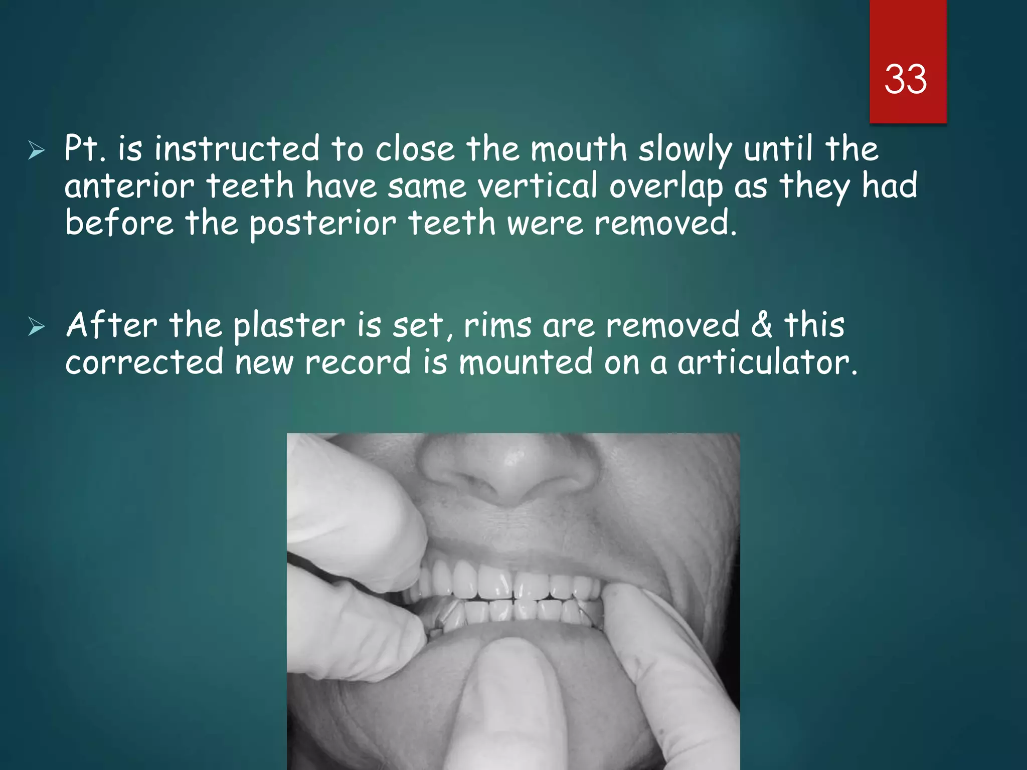 Try in of complete dentures | PPTX