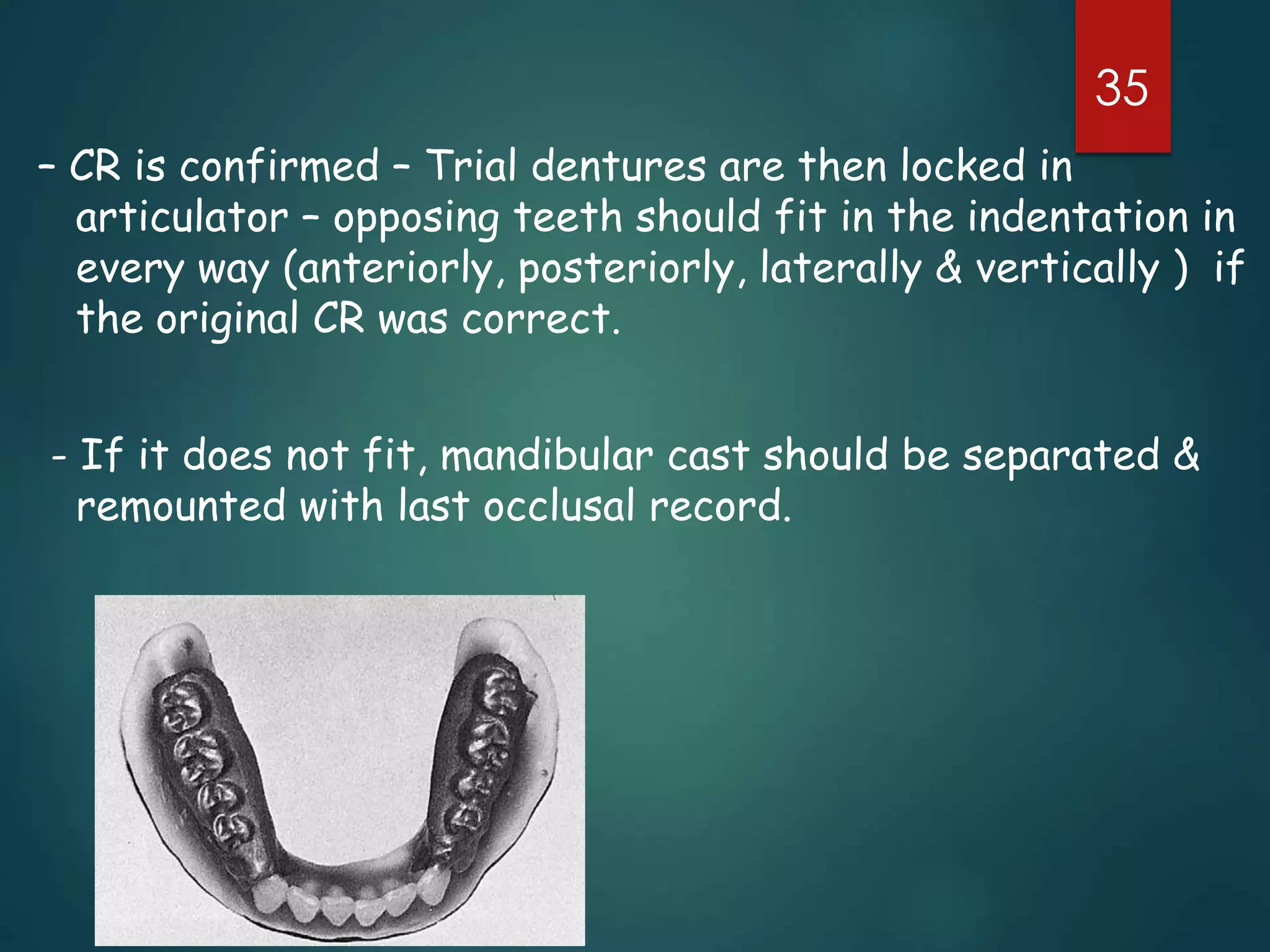 Try in of complete dentures | PPTX