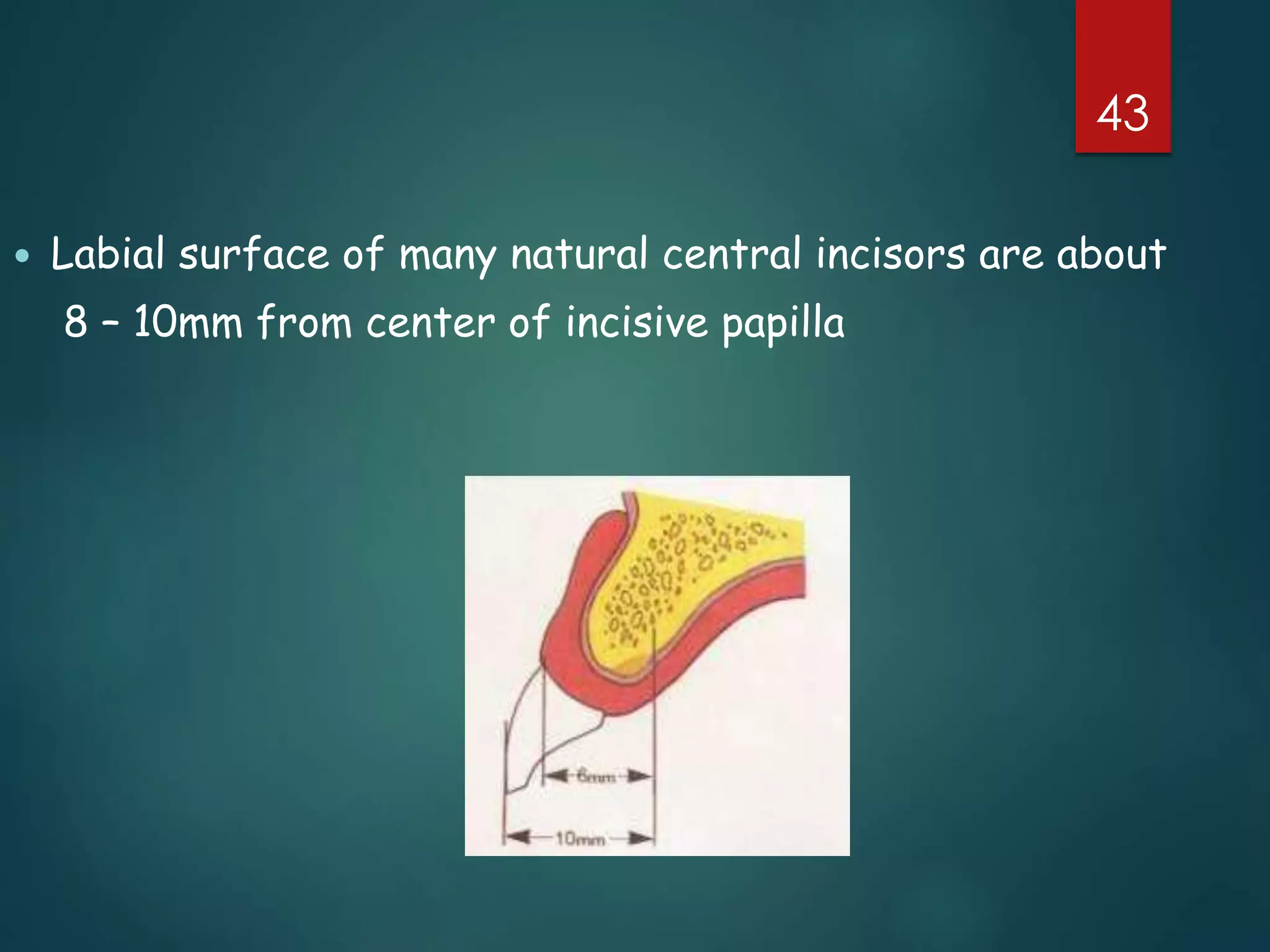 Try in of complete dentures | PPTX