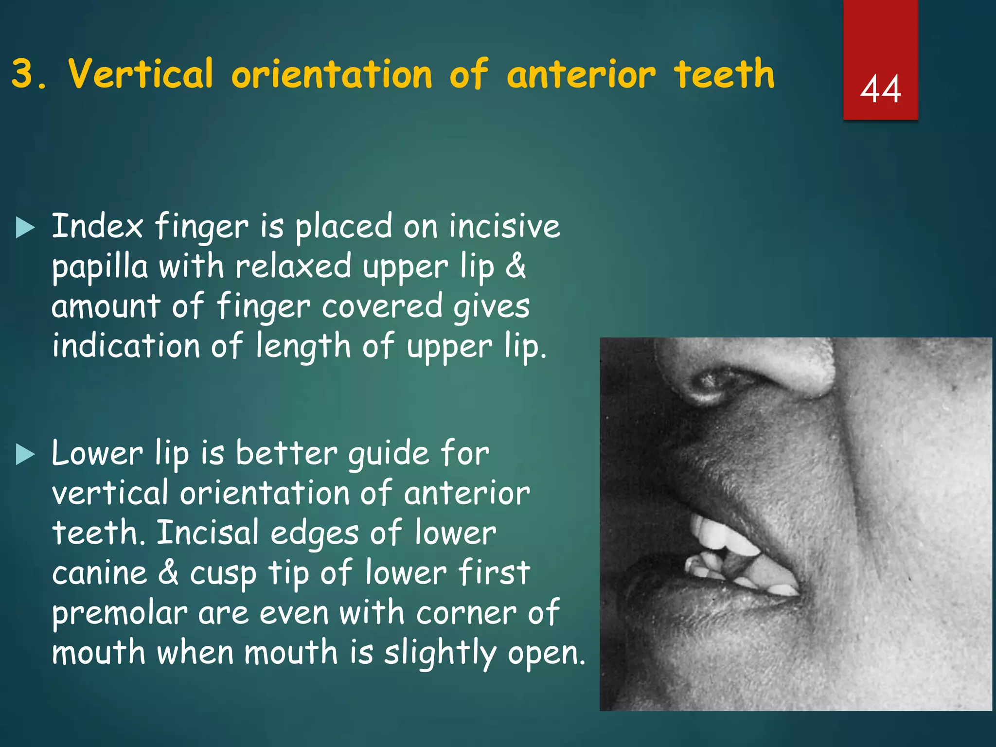 Try in of complete dentures | PPTX