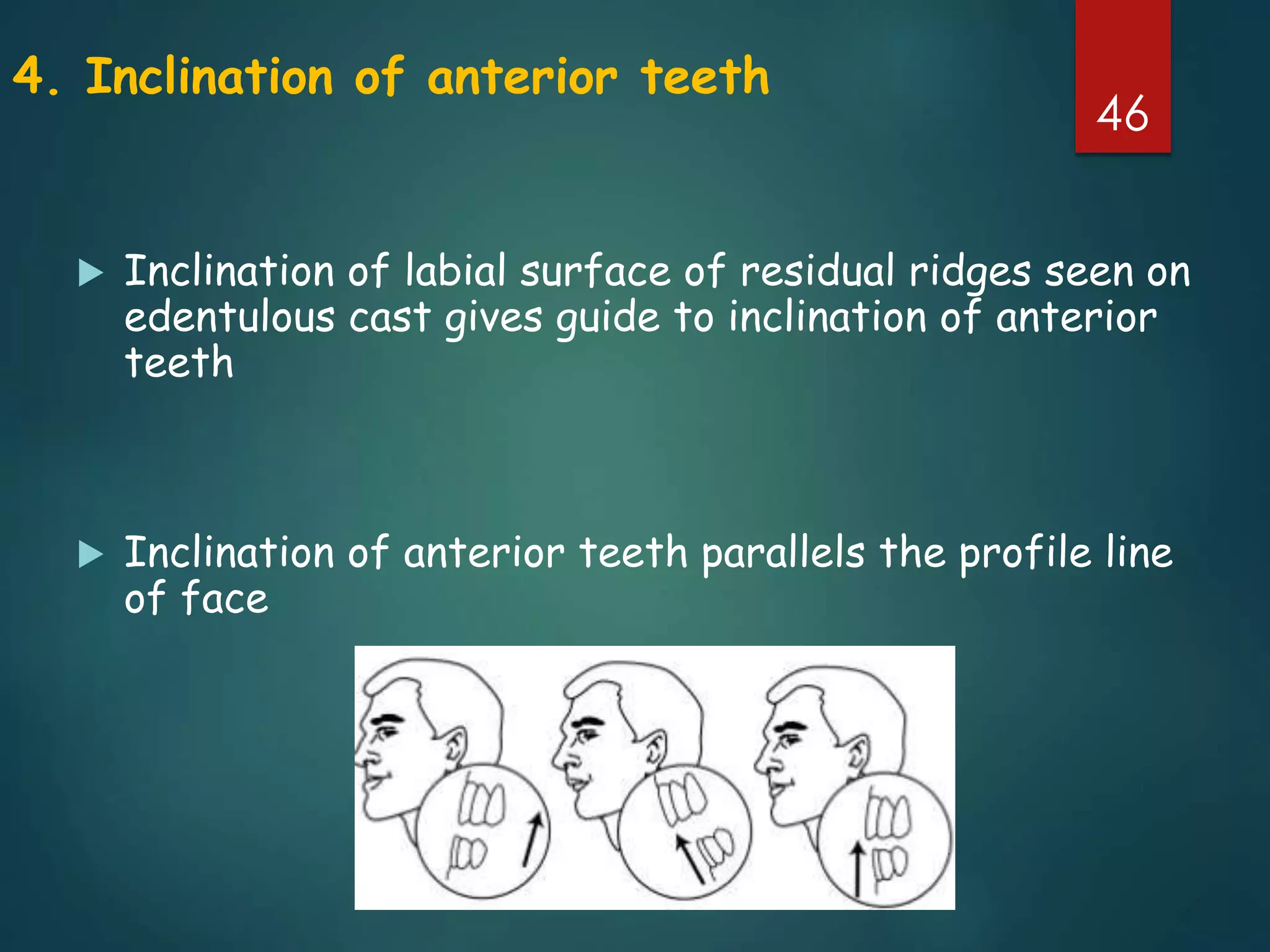 Try in of complete dentures | PPTX
