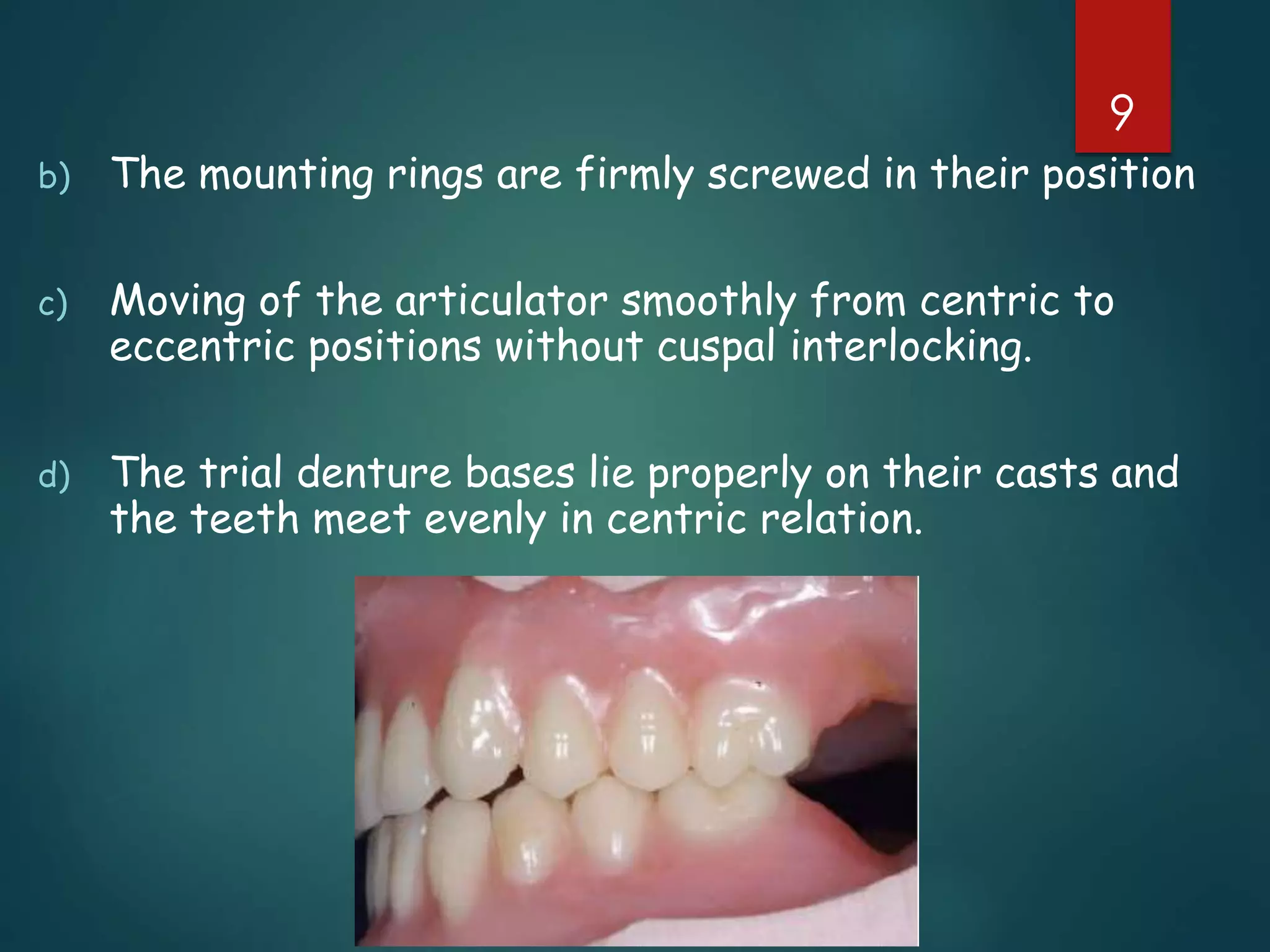 Try in of complete dentures | PPTX