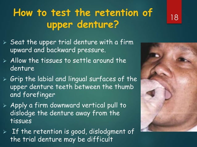 Try in of complete dentures | PPTX