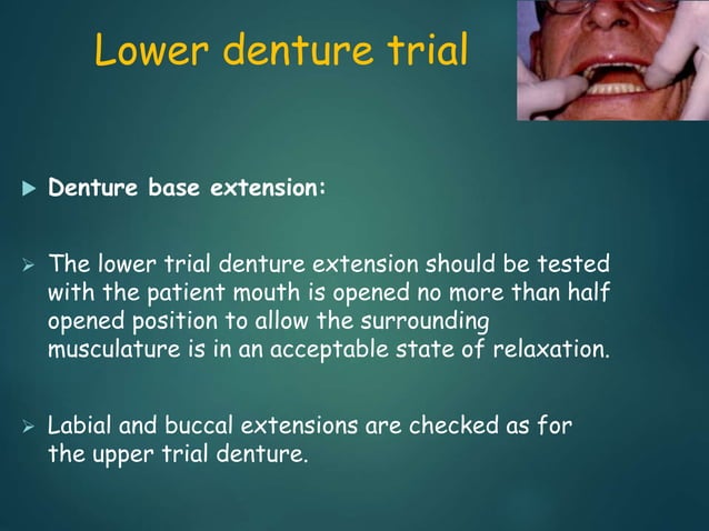 Try in of complete dentures | PPTX