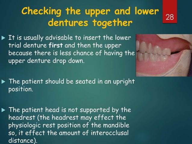 Try in of complete dentures | PPTX