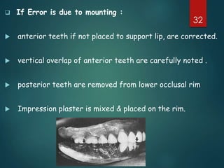 Try in of complete dentures | PPTX