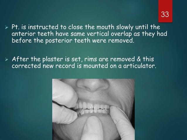 Try in of complete dentures | PPTX