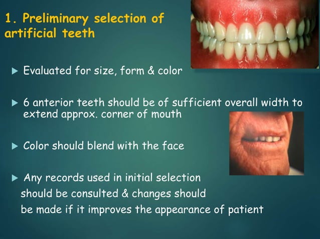 Try in of complete dentures | PPTX