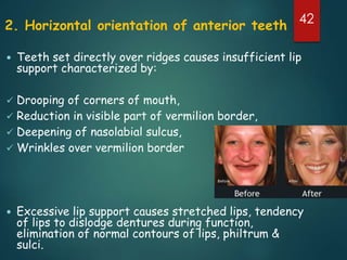Try in of complete dentures | PPTX