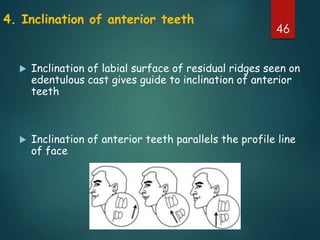 Try in of complete dentures | PPTX