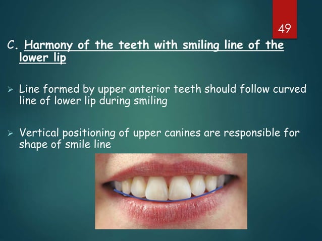 Try in of complete dentures | PPTX