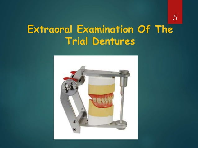 Try in of complete dentures | PPTX