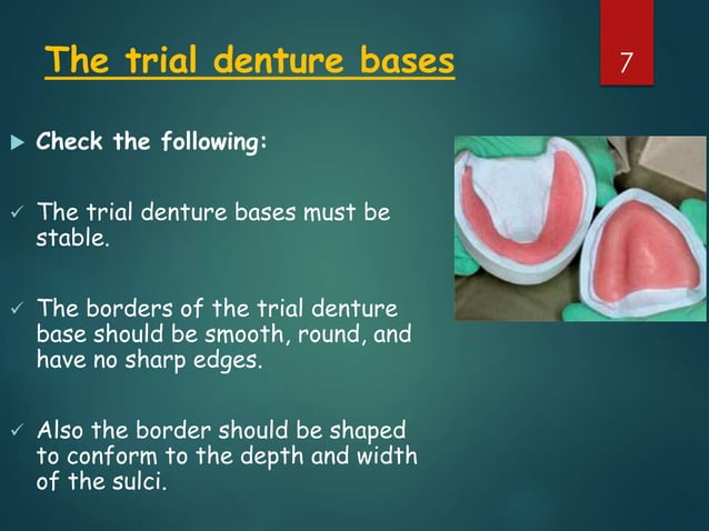 Try in of complete dentures | PPTX