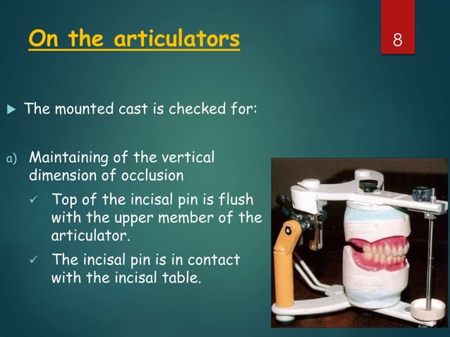 Try in of complete dentures | PPTX