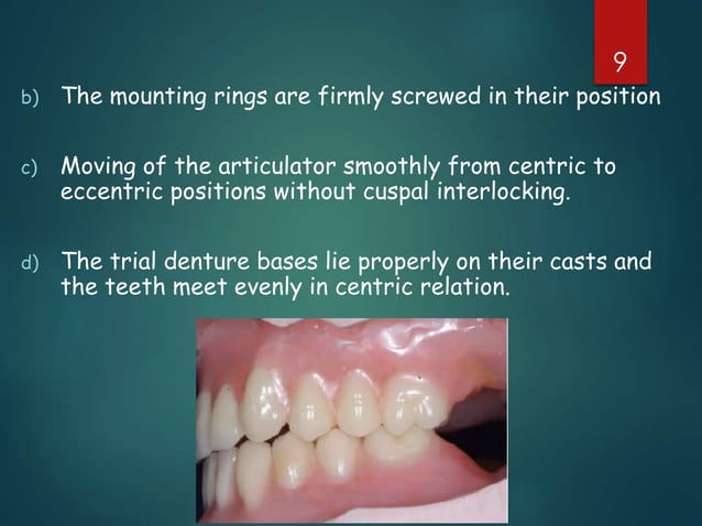 Try in of complete dentures | PPTX