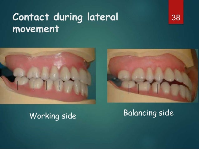 Try in of complete dentures