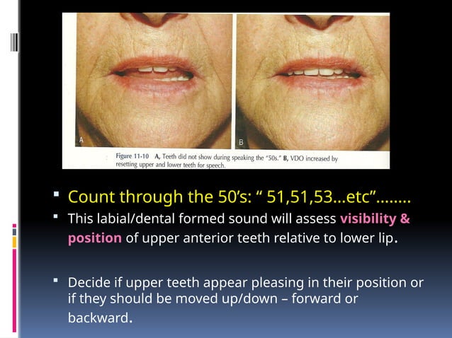 try-in procedure in complete denture presentation | PPTX
