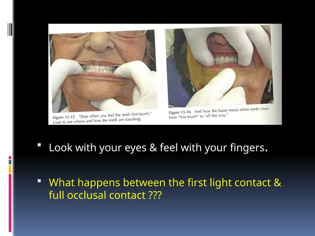 try-in procedure in complete denture presentation | PPT