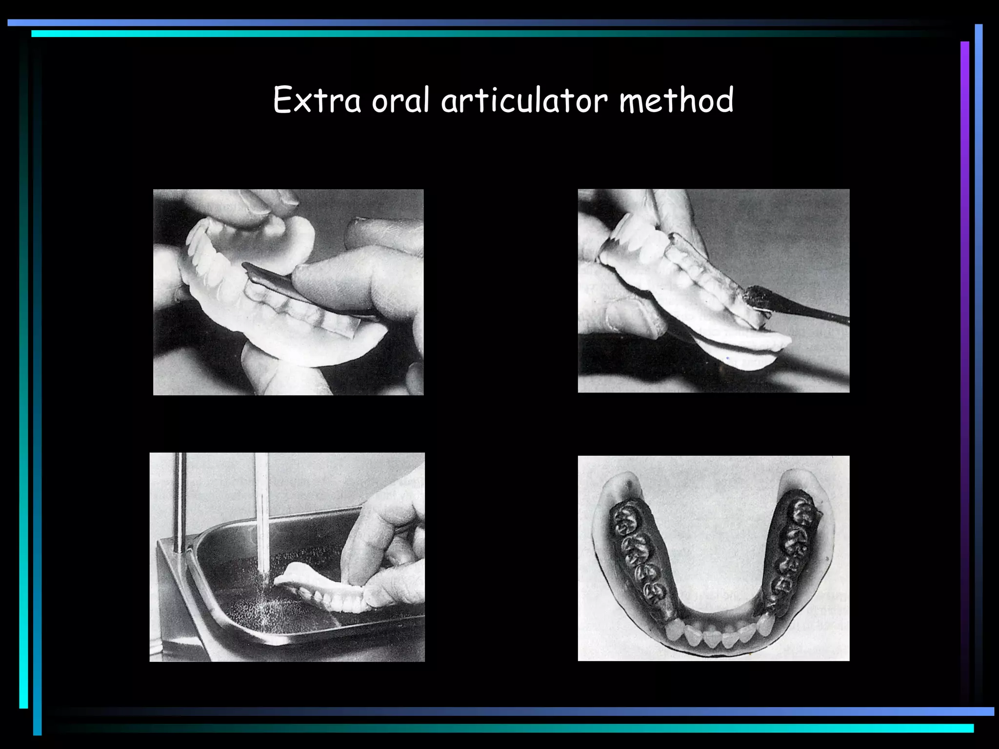 Try in appointment&post insertion instructions | PPT