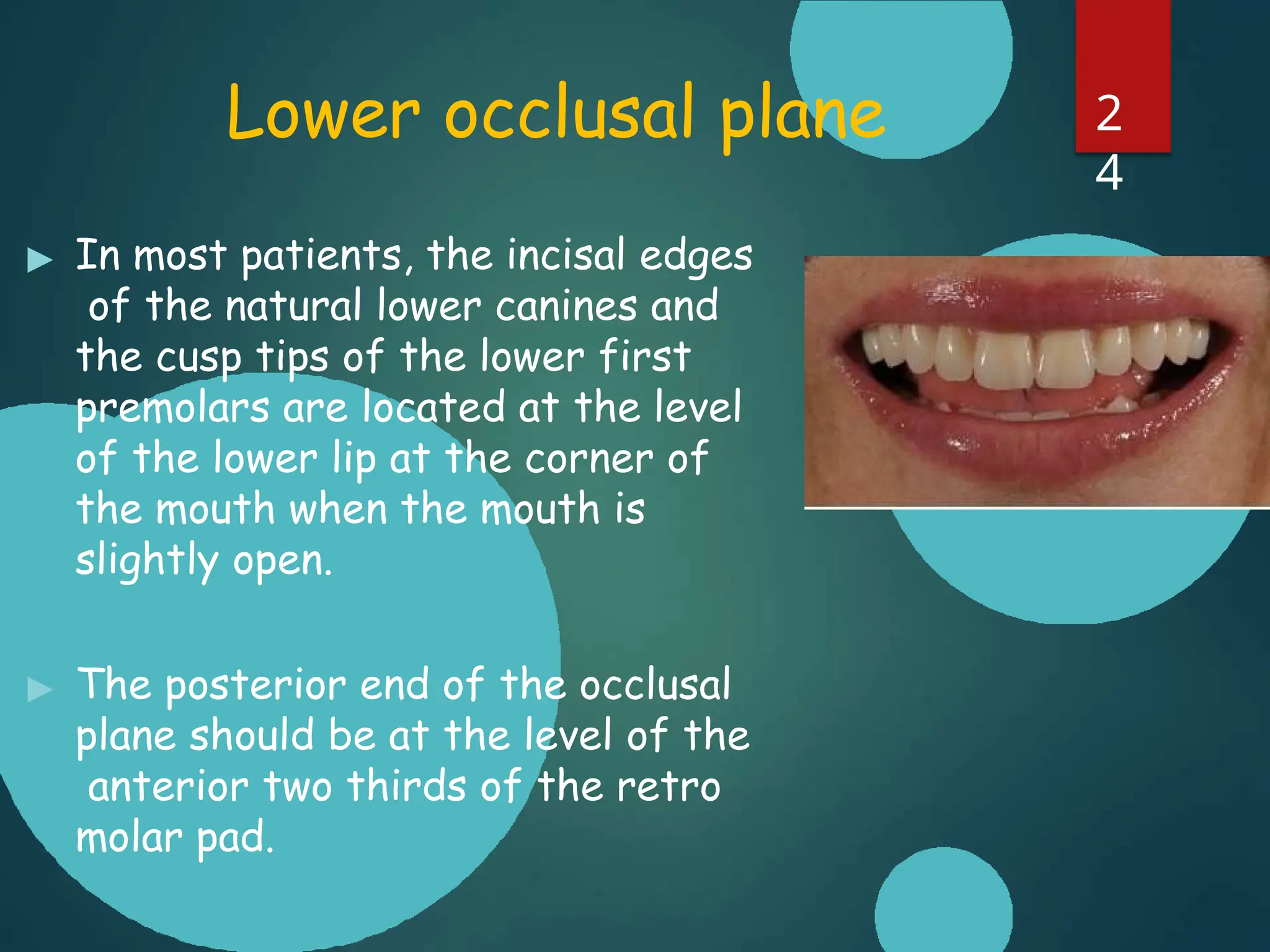 TRY IN CD for edentulous patients in opd | PPTX