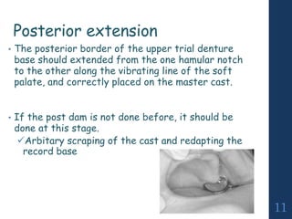 Try in for comlete denture.pptx