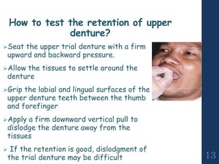 Try in for comlete denture.pptx