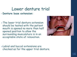 Try in for comlete denture.pptx