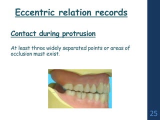 Try in for comlete denture.pptx