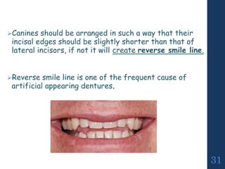 Try in for comlete denture.pptx