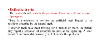 try in RPD.pptx