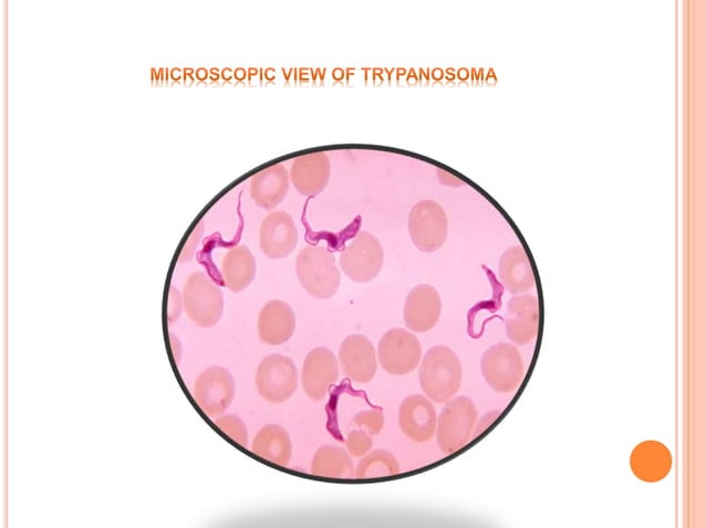 TRYPANOSOMA.pptx