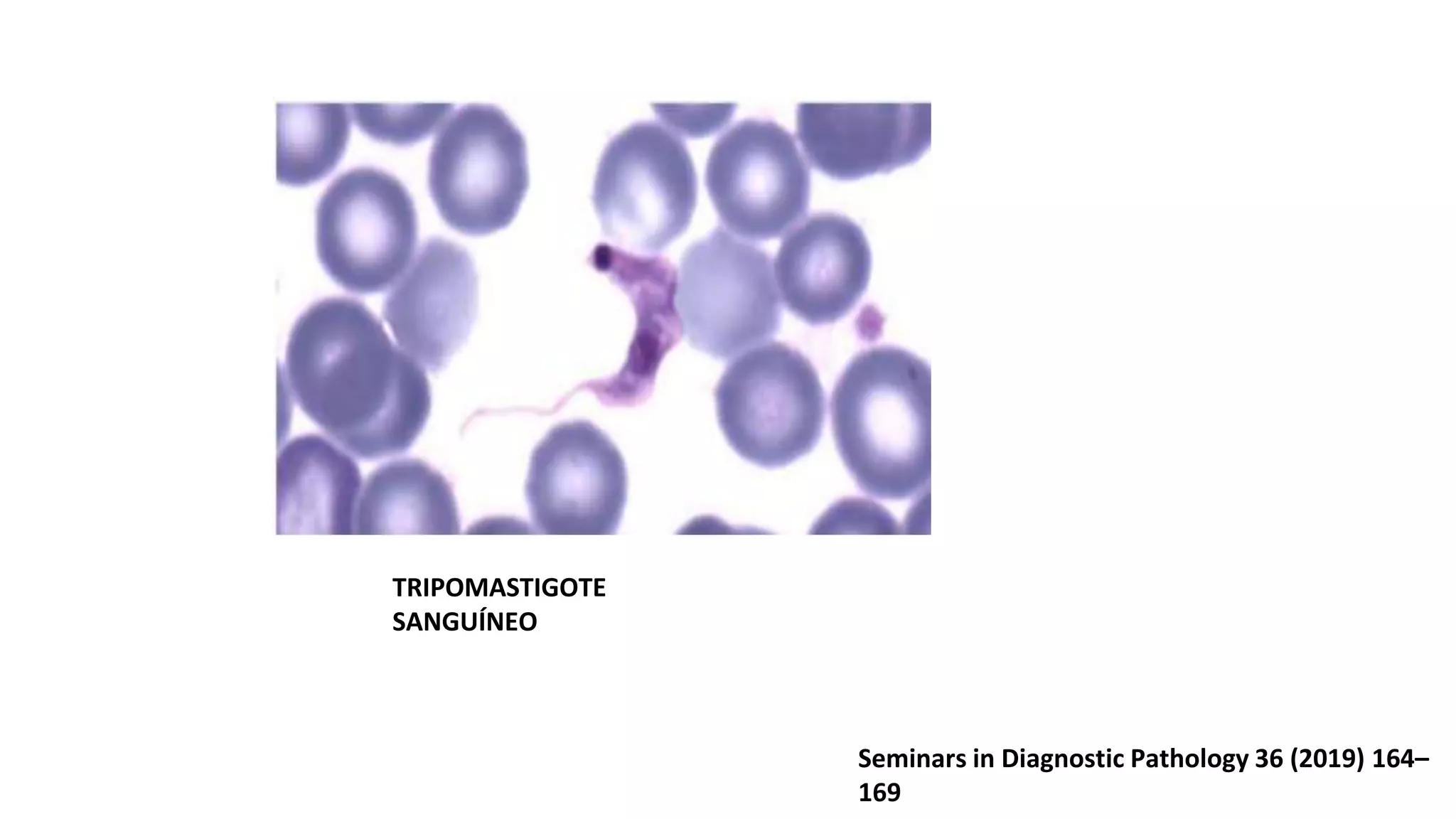 Trypanosoma cruzi | PPTX | Infectious Diseases | Diseases and Conditions