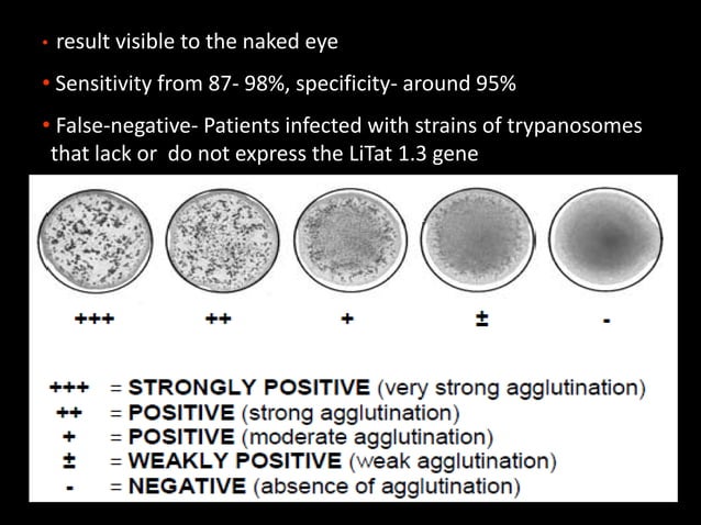 Trypanosomiasis | PDF | Africa Travel | Travel Locations