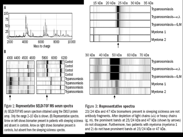 Trypanosomiasis | PDF | Africa Travel | Travel Locations