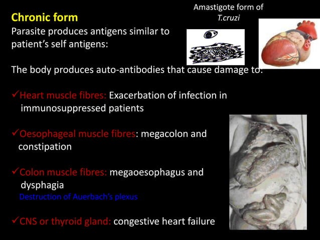 Trypanosomiasis | PDF | Africa Travel | Travel Locations