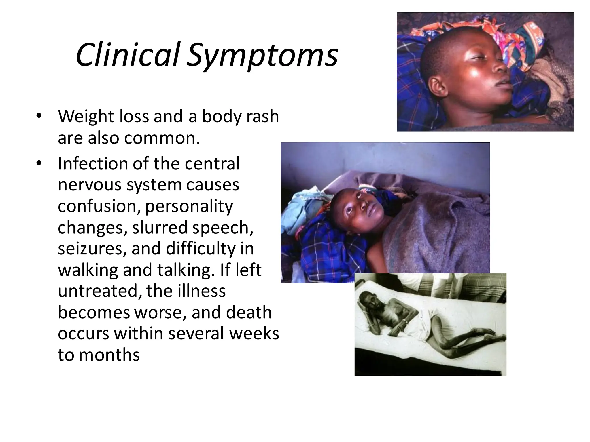Trypanosomiasis, Sleeping sickness disease of Africa | PDF