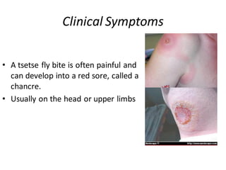 Trypanosomiasis, Sleeping sickness disease of Africa | PDF