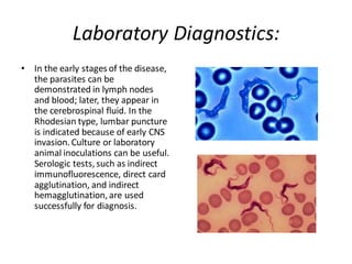 Trypanosomiasis, Sleeping sickness disease of Africa | PDF