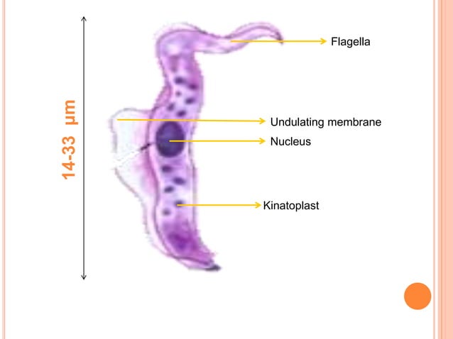TRYPANOSOMIASIS microbiology lab investigation and investigation.pptx