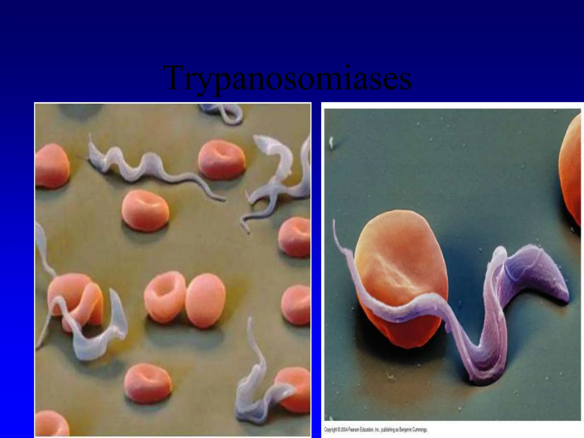Trypanosomiasis Dr Nzau Muange, MBCHB,MMeD2021.ppt