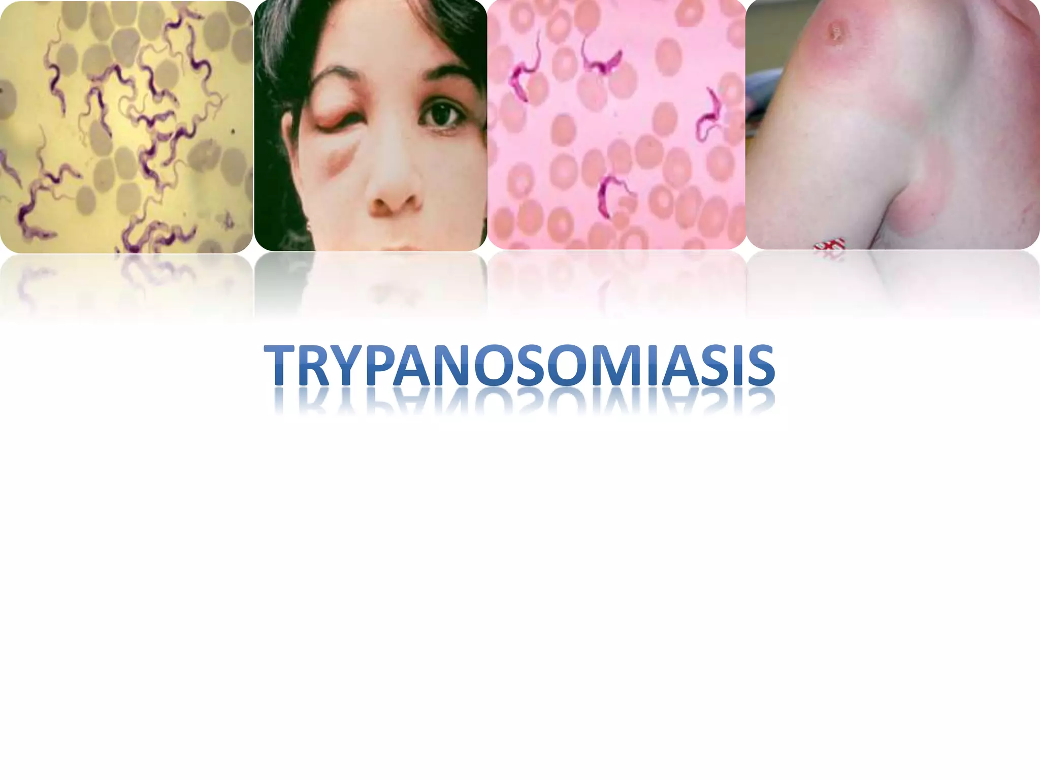 Trypanosomiasis .pptx