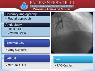 Case based tutorial on bifurcation dedicated stent Tryton placement | PPT