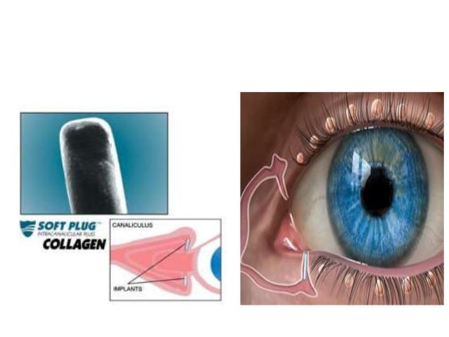 TEAR SUBSTITUTES tear-substitutes