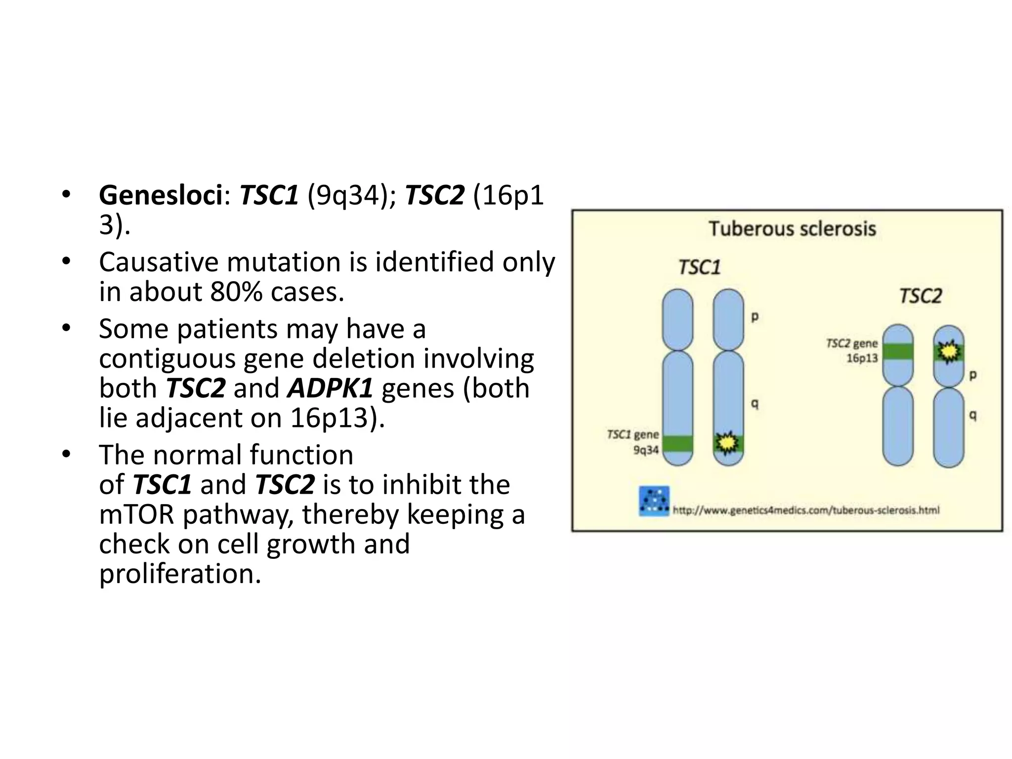 Tuberous sclerosis | PPTX