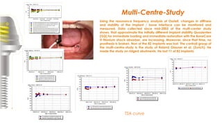 Tsa biomechanical abutment | PPT