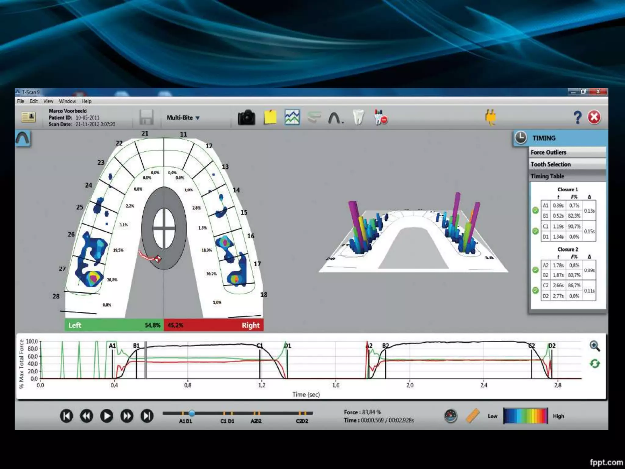 T scan and its application in orthodontics | PPTX