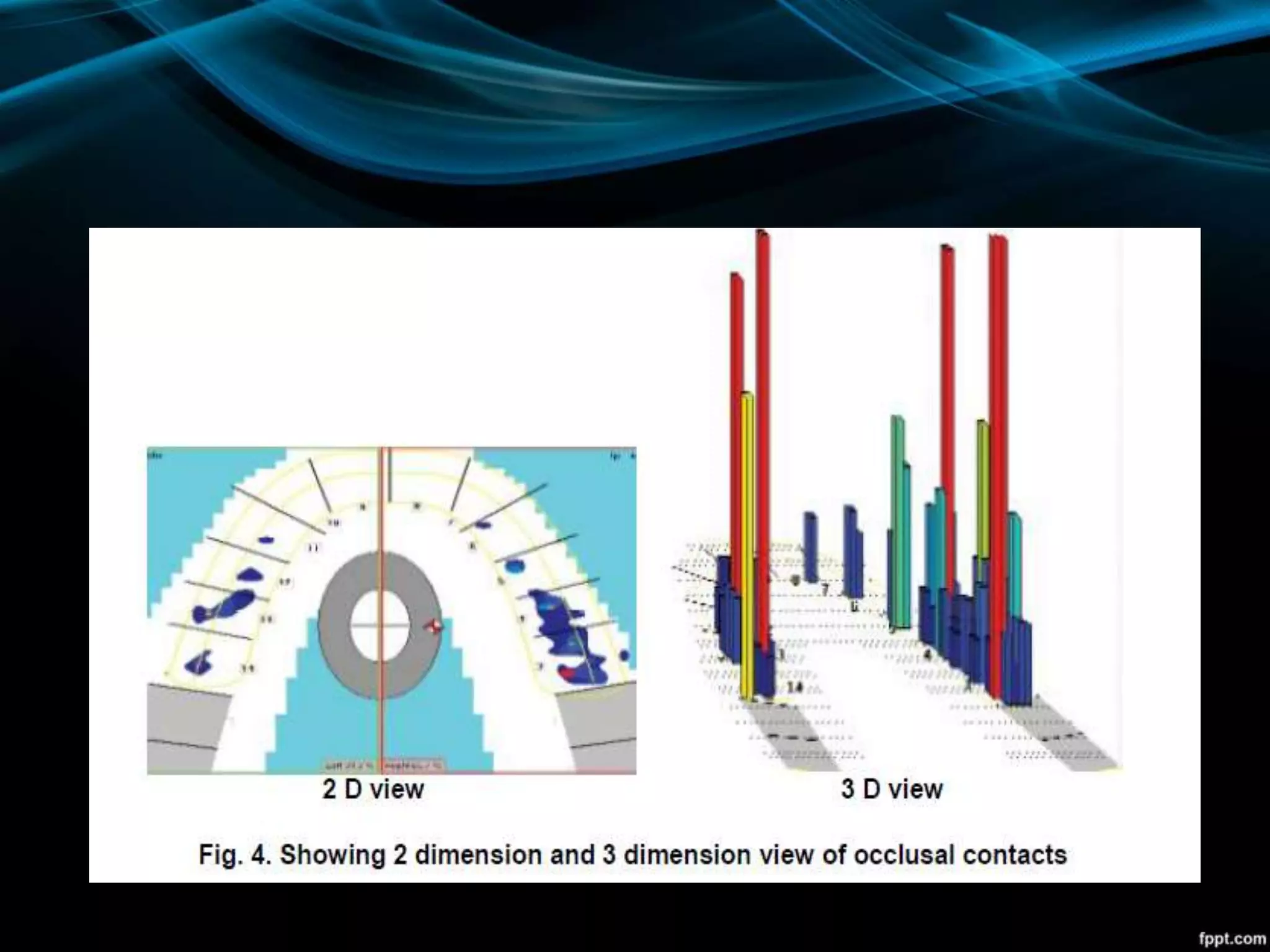 T scan and its application in orthodontics | PPTX