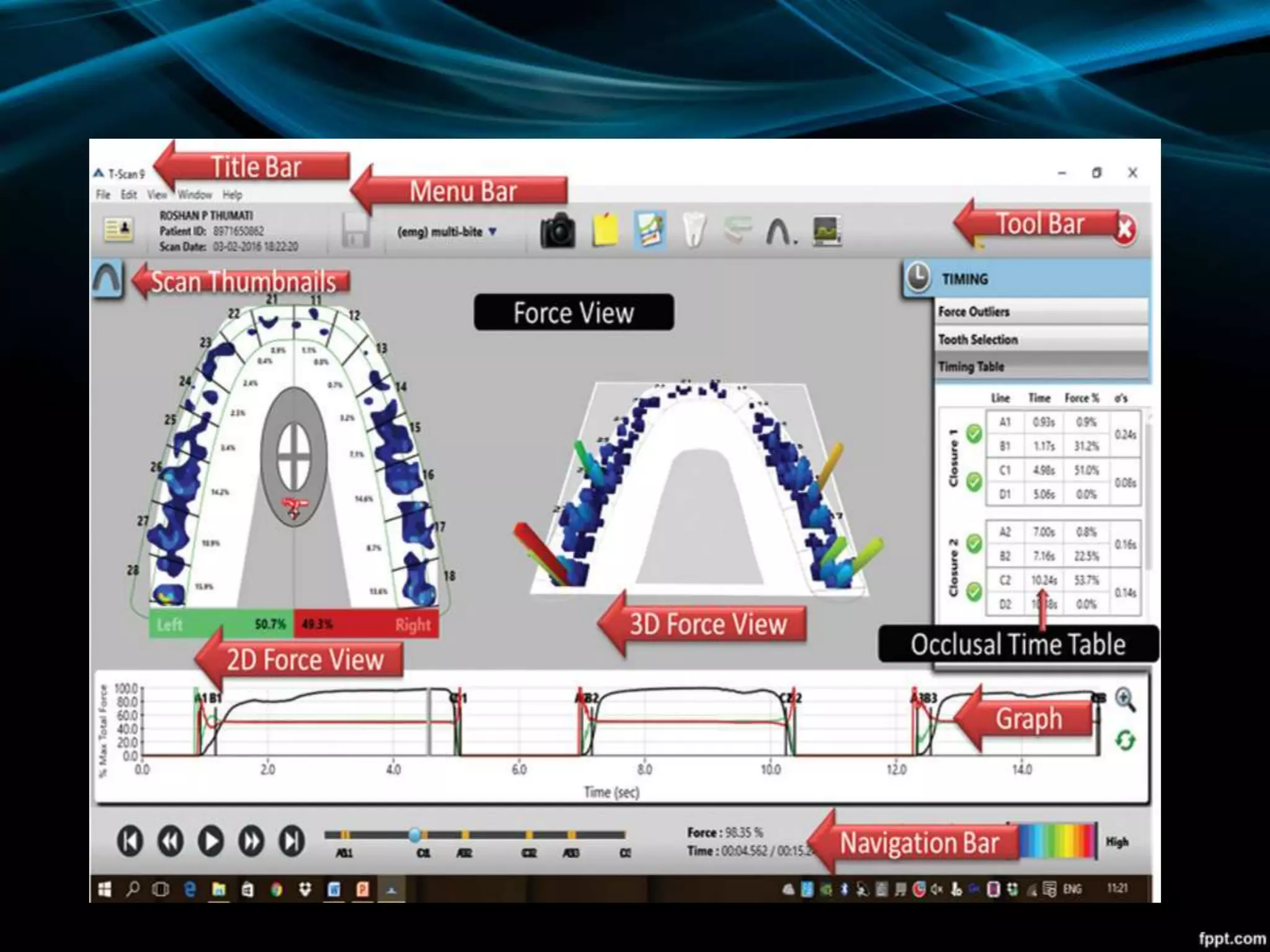 T scan and its application in orthodontics | PPTX