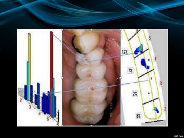 T scan and its application in orthodontics | PPTX
