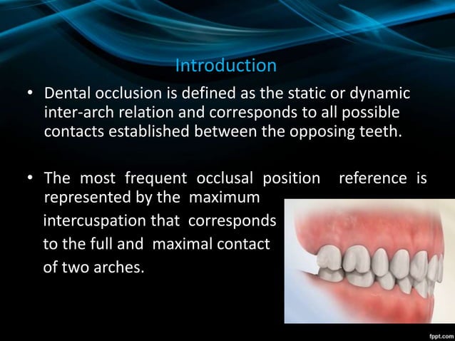 T scan and its application in orthodontics | PPTX